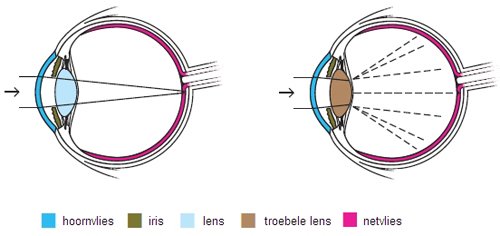 Staar - Luckylook.nl